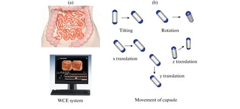 A Wce Imaging System Wirelessly Transmits Images That Are Later Download Scientific Diagram