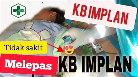 Cara Melepas KB IMPLAN Aman dan mudah Tahun 2020 bersama Bidan Cantik - YouTube