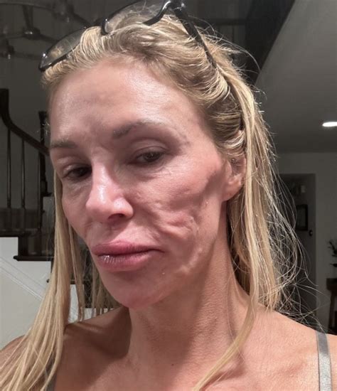 The Traitors Star Fears She Has Sexually Transmitted Ringworm Metro