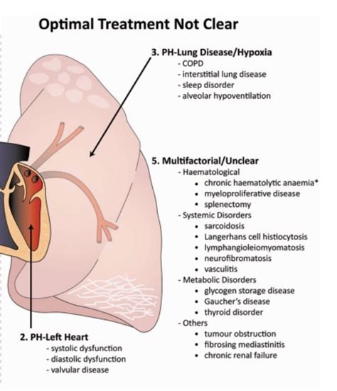 Pulmonary Htn In Pregnancy The Dark Neb Tuohy Time