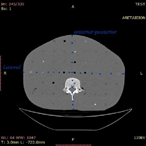 Pdf Effective Dose And Size Specific Dose Estimate Ssde Of The