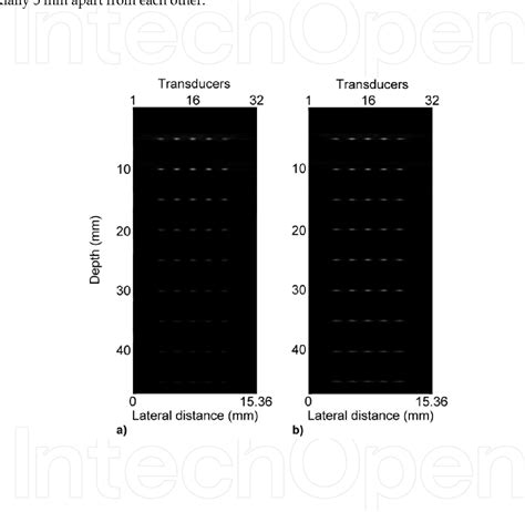Figure 1 From Synthetic Aperture Method In Ultrasound Imaging Semantic Scholar