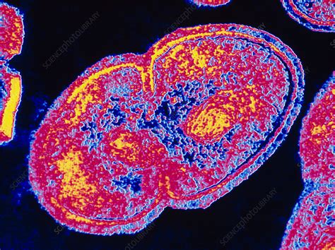 Coloured TEM Of Enterococcus Faecalis Stock Image B Science Photo Library