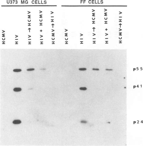 Effect Of Timing Of Hcmv Infection On Hiv Protein Synthesis U373 Mg Download Scientific