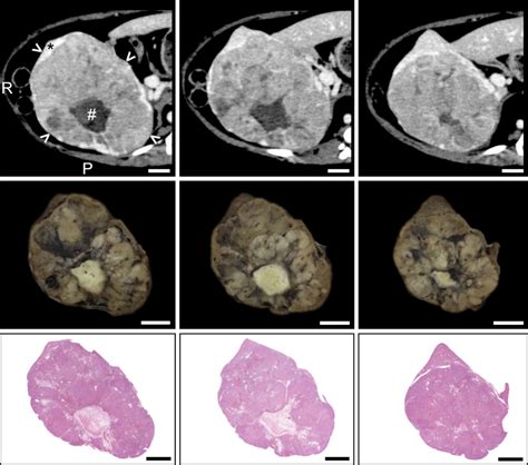 Sequential Sections From A Formalin Fixed Tumor Specimen With