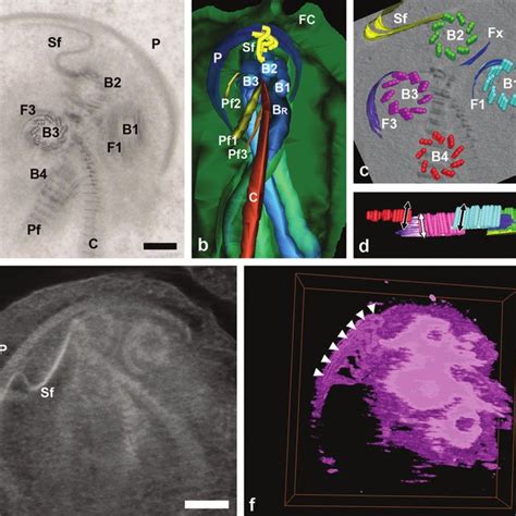 Structure Of Trichomonas Vaginalis A Scanning Electron Microscopy Download Scientific