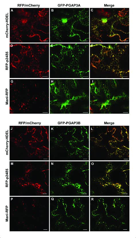Localization Of Gfp Pgap3a And Gfp Pgap3b Transient Expression In N