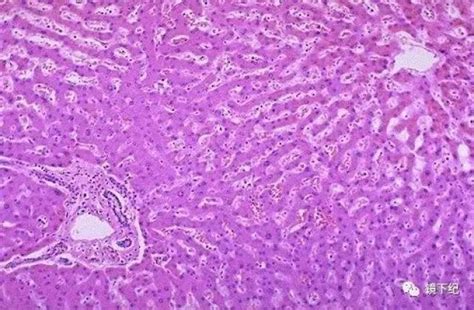 肝小叶实验报告手绘图 肝小叶红蓝铅笔手绘图 肝小叶手绘图 第3页 大山谷图库
