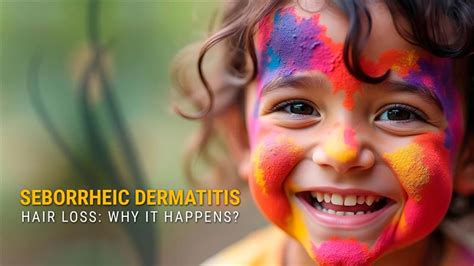Seborrheic Dermatitis Hair Loss Why It Happens And How To Treat Theradome