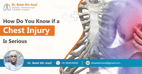 Lung Nodule Size Chart Dr Belal Bin Asaf