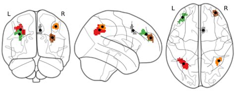Github Lrq3000neuro Python Plotting Various Scripts To Plot Neuroimaging Results Using Python