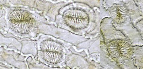 Guard Cell Microscope