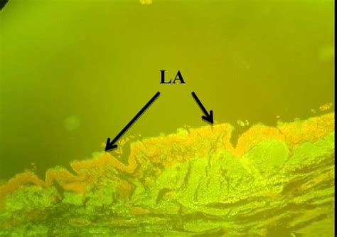 Microphtograph By Fluorescent Microscope Analysis Of Bronchi In Duck