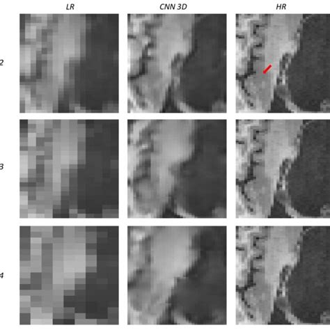 Schematic Representation Of Our Network Architecture Our Autoencoder