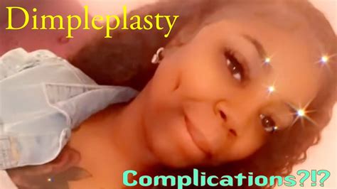 Storytime Dimpleplasty Procedure Q And A Youtube