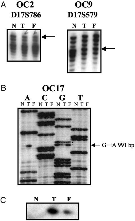 A Representative Results Of Microsatellite Marker Analysis Arrows
