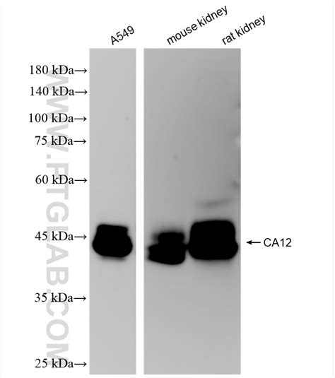 Ca12 Antibody 85595 3 Pbs Proteintech