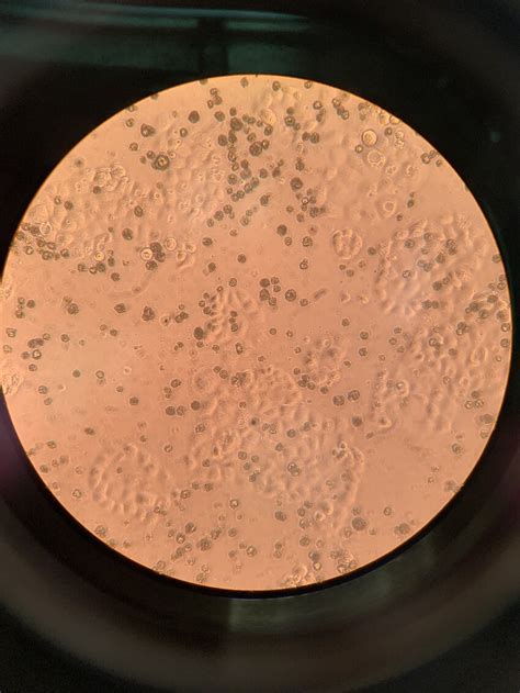 Cell Debris Or Contamination Researchgate