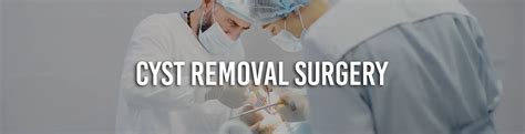 Cyst Removal Available Surgical Procedures And Options Medical Blogs