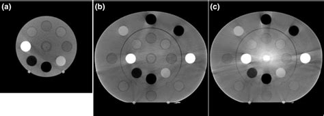 Cone Beam Computed Tomography Images Acquired Using Each Protocol A Download Scientific