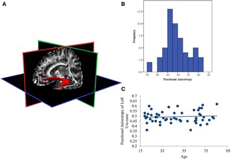 A Representative Posterior Distribution Of The Reconstructed Uncinate