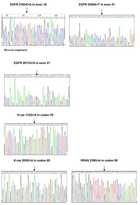 Epidermal Growth Factor Receptor And K Ras Mutations Download Scientific Diagram