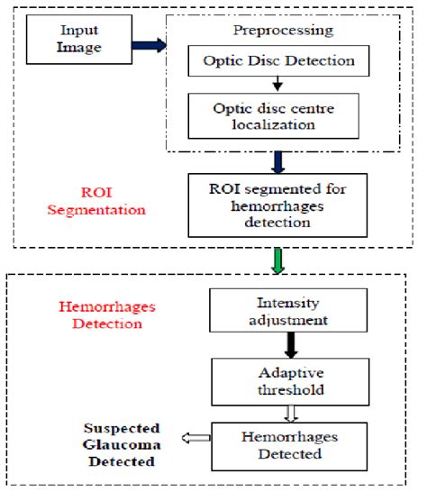 Detection Of Suspected Glaucoma Download Scientific Diagram