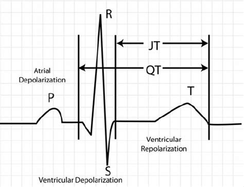 QT Intervals Were Measured From The Point Where The Q Wave Started And Download Scientific