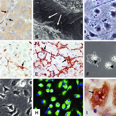 Representation Of Histotypic Liver Microstructure A Diagram Of The Download Scientific