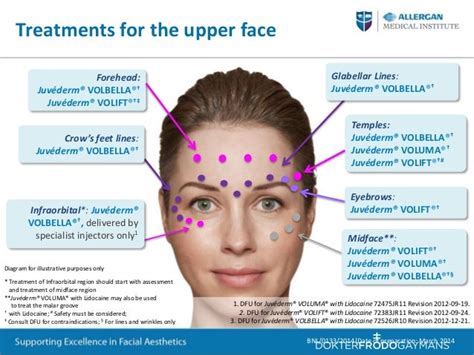 Training For Periorbital And Upper Face Treatment With Botox And Juve…