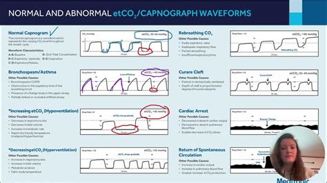 Waveform Capnography Capstone Youtube