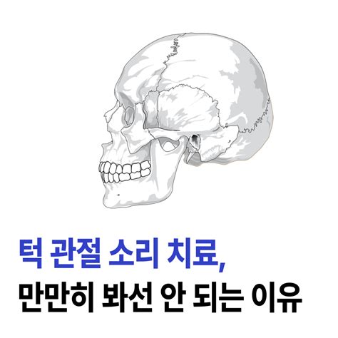 턱 관절 소리 치료방법 자세히 알아보고 이것 부터 고치세요 최신정보