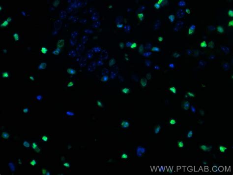 Sox2 Antibody 66411 1 Ig Proteintech