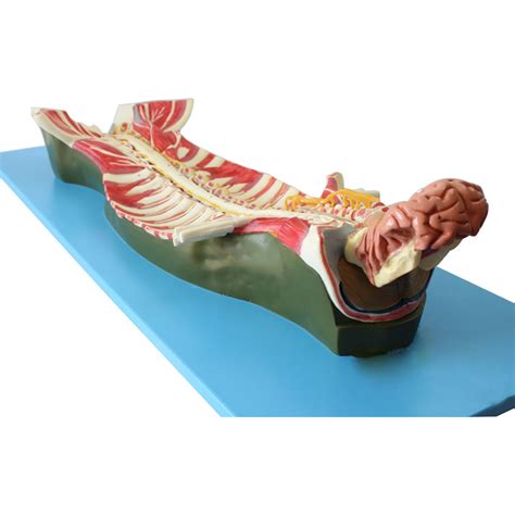 Anatomy Model Spinal Cord In The Spinal Canal