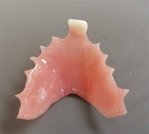 Flipper Partial Cae Dental