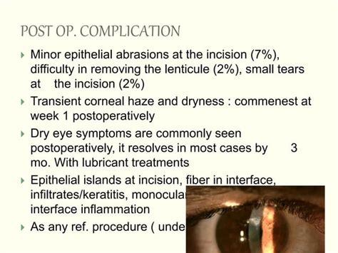 Just Smile Small Incision Lenticule Extraction Pptx Eye And Vision Conditions Diseases