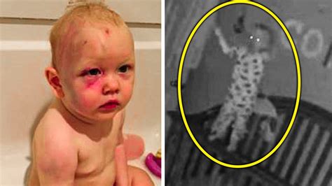 A Mother Put A Hidden Camera Because Her Son Wakes Up With Bruises What She Discovered Was