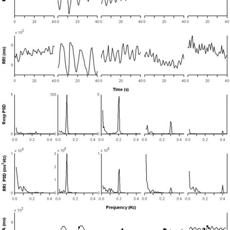 Representative Examples Of Respiratory Signals Resp And The Download Scientific Diagram