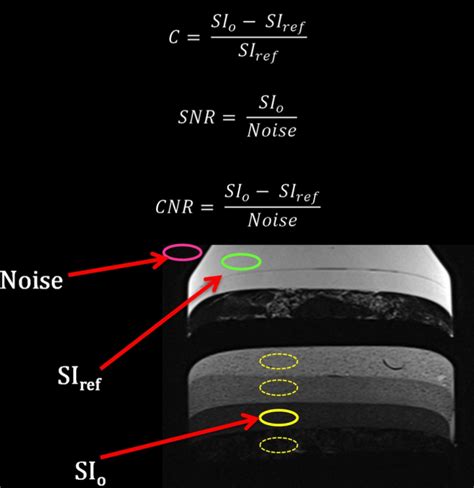 Contrast To Noise Ratio Definition And Importance Uni X Ray