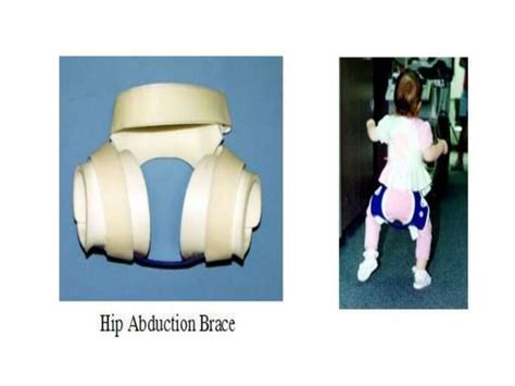 Dislocation Of Hip Pptx Pregnancy Reproductive Health