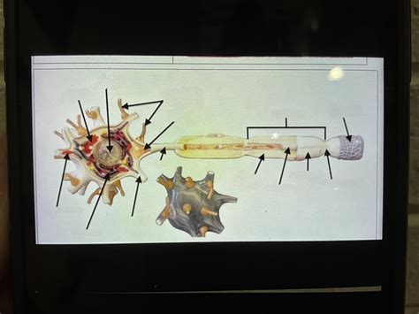 Motor Neuron LAB EXAM Diagram Quizlet