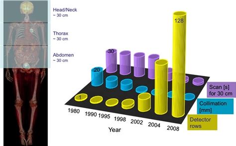 Performance Of Ct Systems Expressed As Number Of Detector Rows And Download Scientific Diagram