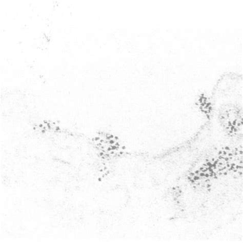 Transmission Electron Micrograph Of A Type Pneumocyte From The Lung Of