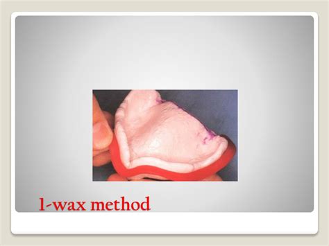 Ppt Impression Tray And Impression Technique Powerpoint Presentation