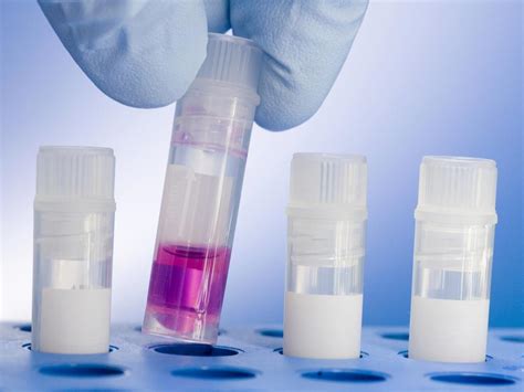 Helping Couples With Unexplained Infertility Navigate Best Treatment Nt News