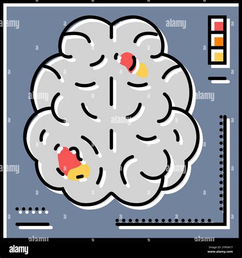 Functional Mri Brain Stock Vector Images Alamy