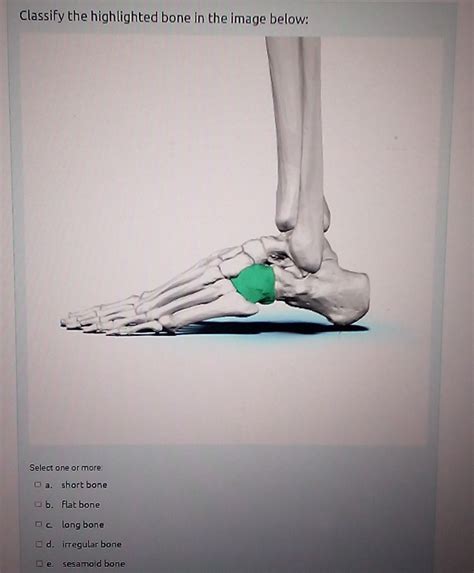 solved classify the highlighted bone in the image