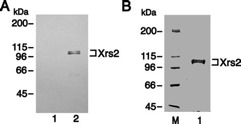 Yeast Xrs2 Binds Dna And Helps Target Rad50 And Mre11 To Dna Ends