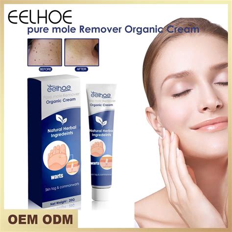 Verruca Removing Beautiful Cream Cleanses The Body Fades Skin Flesh
