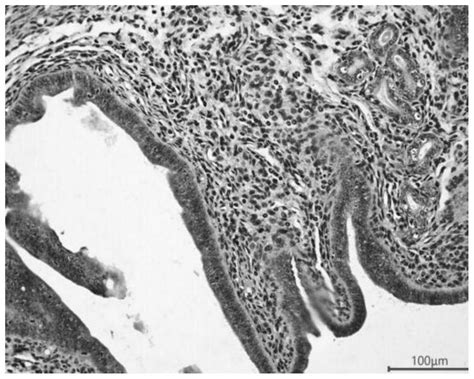 Polymorphic Self Adaptive Bio Based Endometrial Repair Material And Preparation Method Thereof